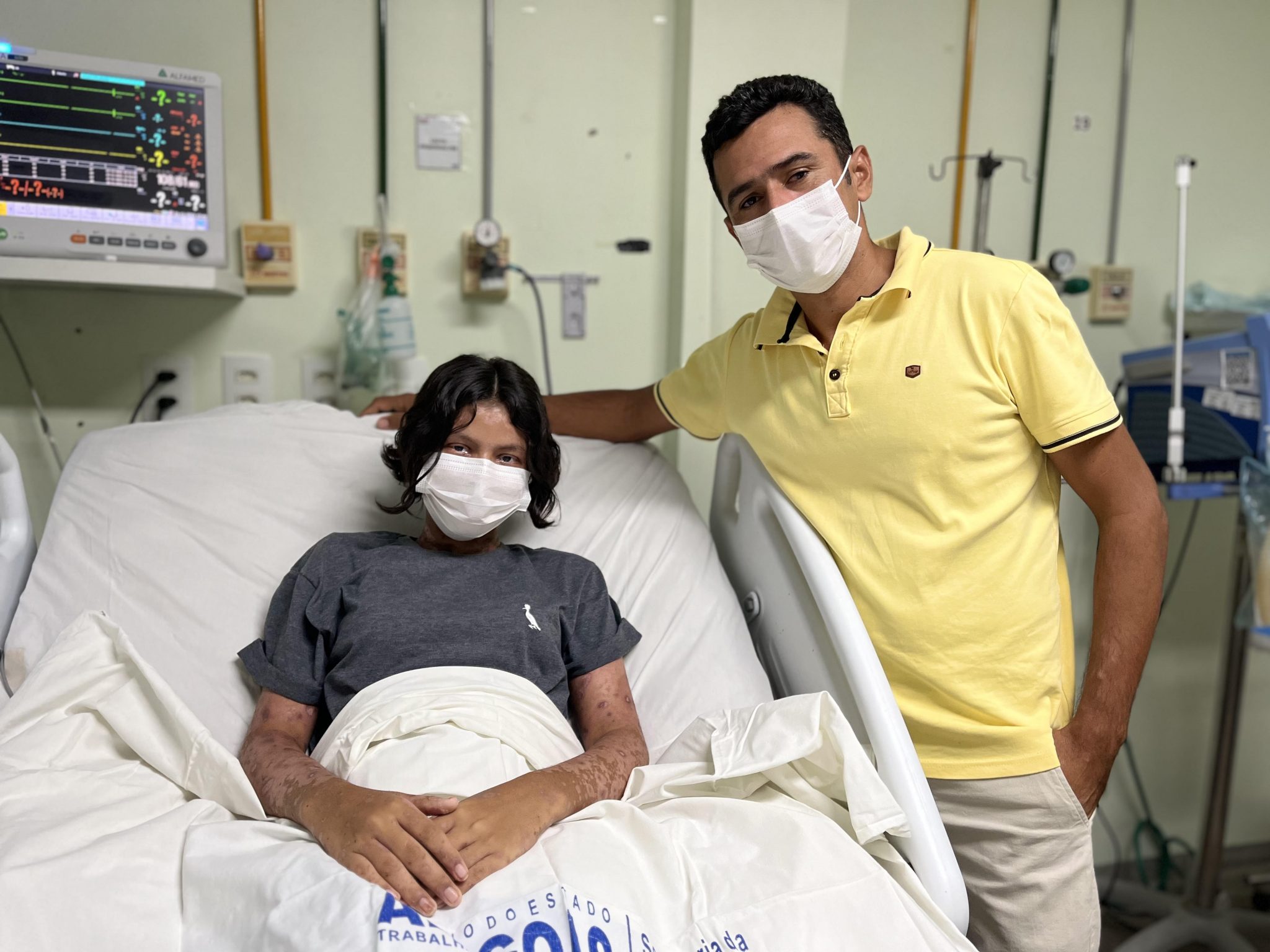 HGE salva a vida de adolescente de 14 anos que teve Síndrome de Lyell ...
