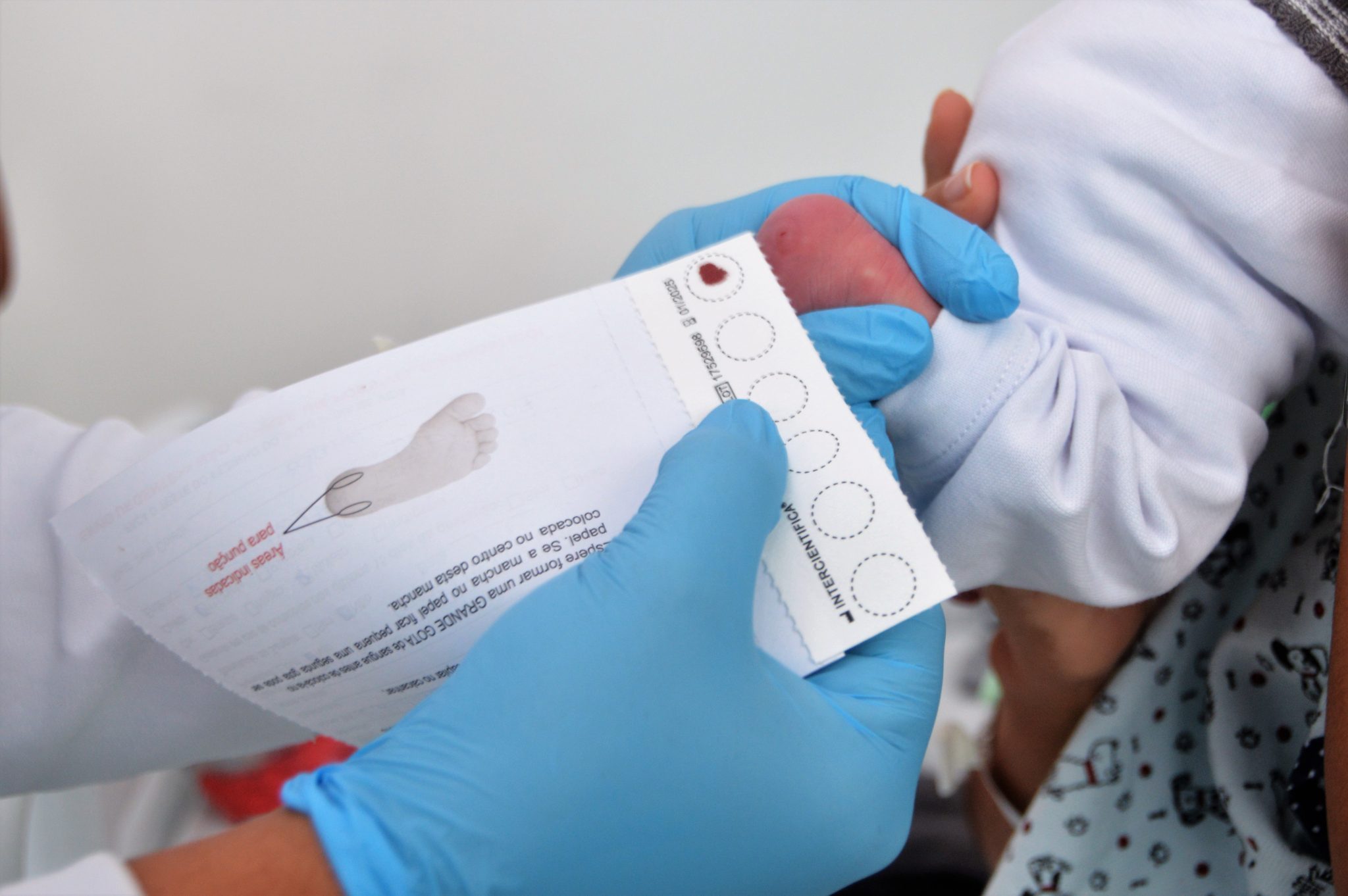 Sesau promove Treinamento Sobre Triagem Neonatal para profissionais de ...